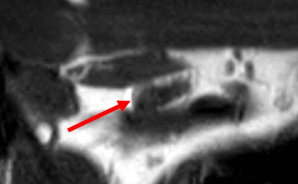 MagSense® Technology | Imagion Biosystems